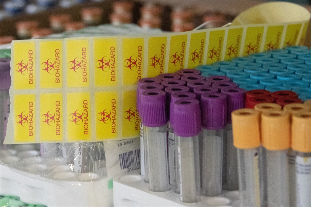 Τεστ για κορωνοϊό στο προσωπικό των ΓΝ Λάρνακας και Αμμοχώστου | Philenews