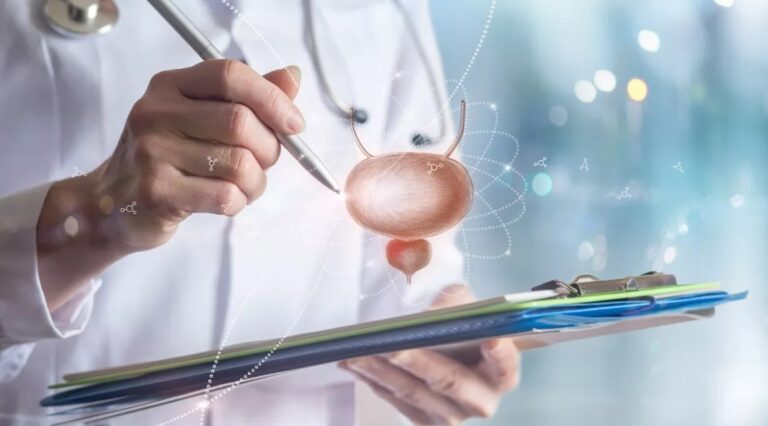 1 στους 5 ασθενείς με αιματουρία έχει καρκίνο ουροδόχου κύστης